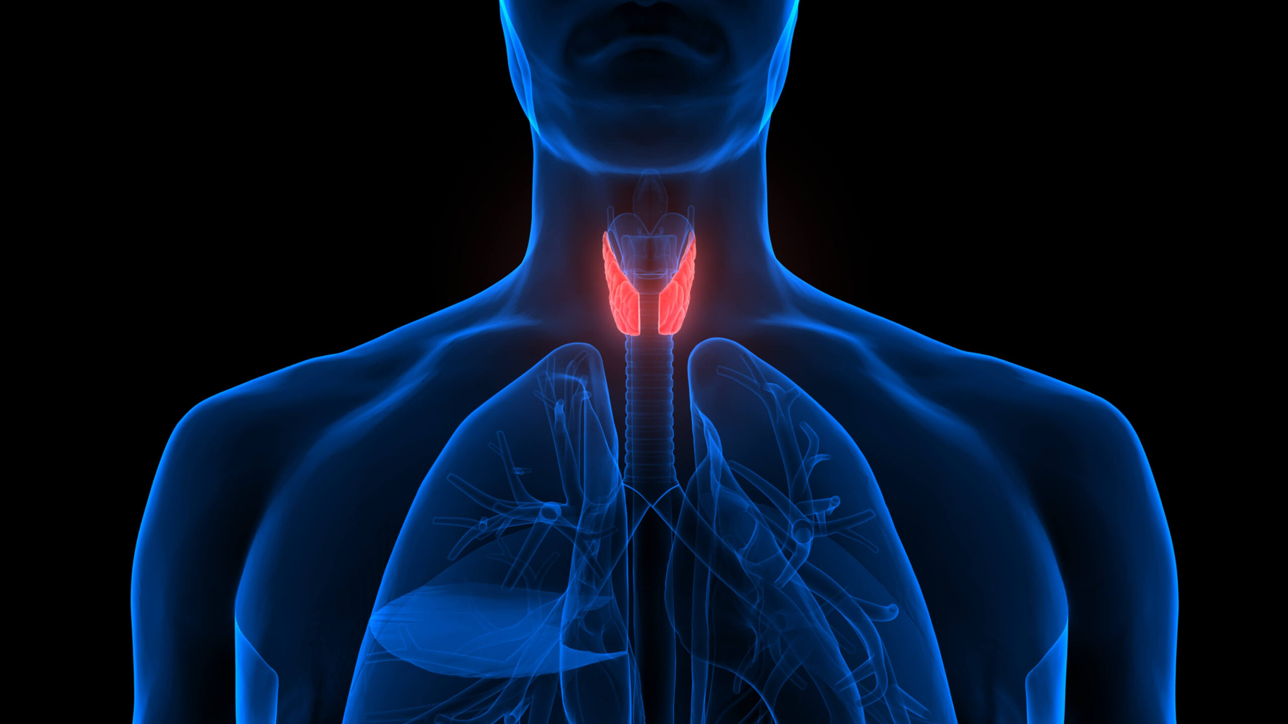 Thyroid Cancer - FeM Surgery